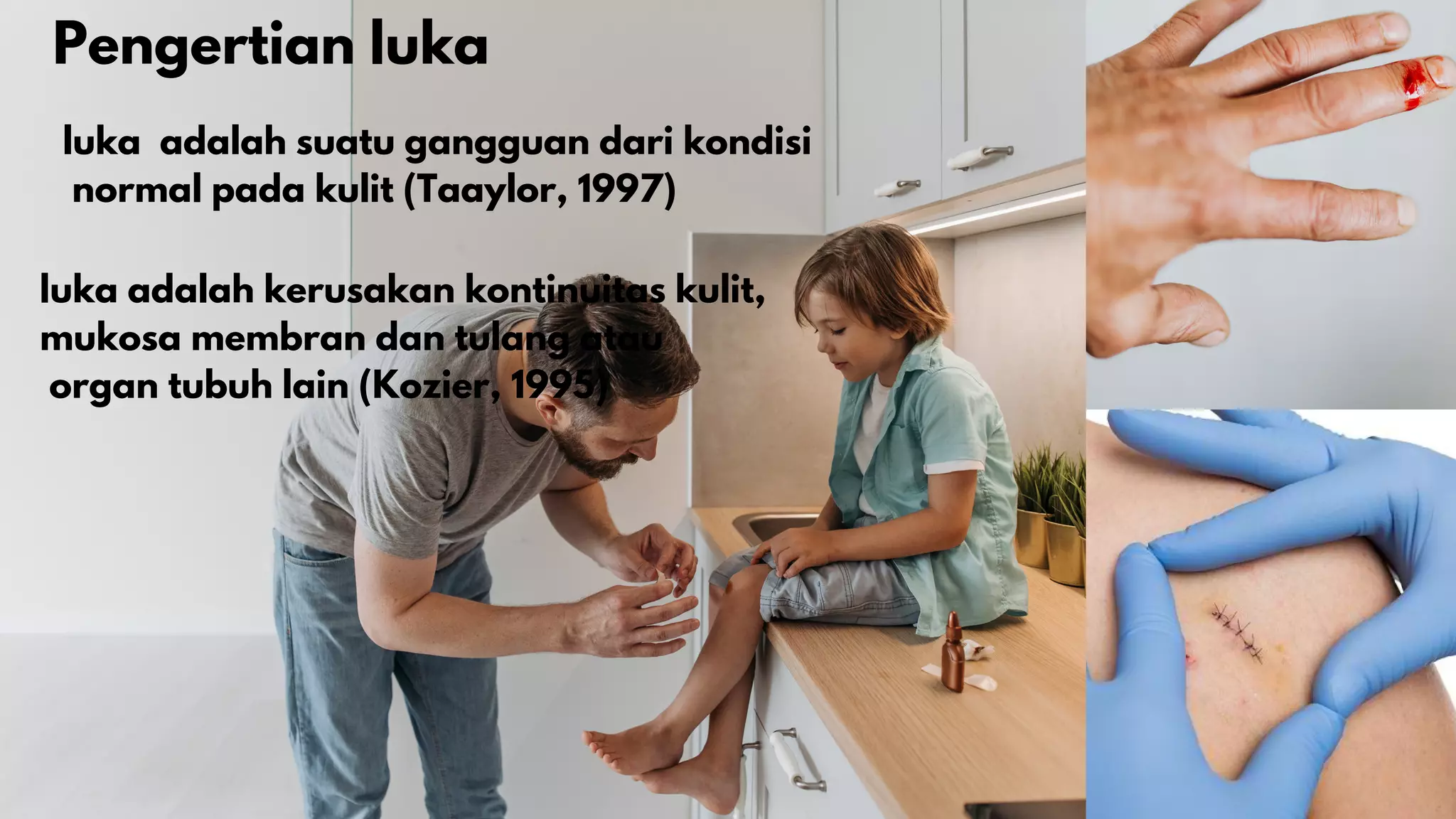 PPT PERAWATAN LUKA. IRA ANGGRIANI.pdf