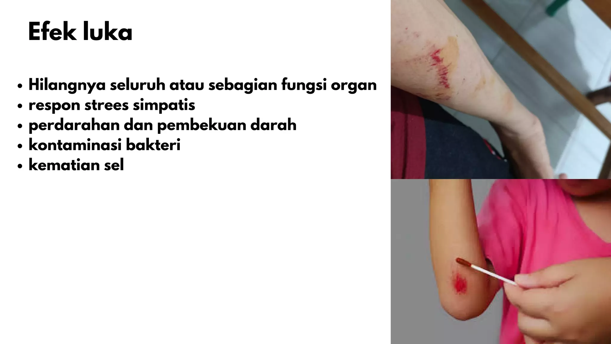 PPT PERAWATAN LUKA. IRA ANGGRIANI.pdf