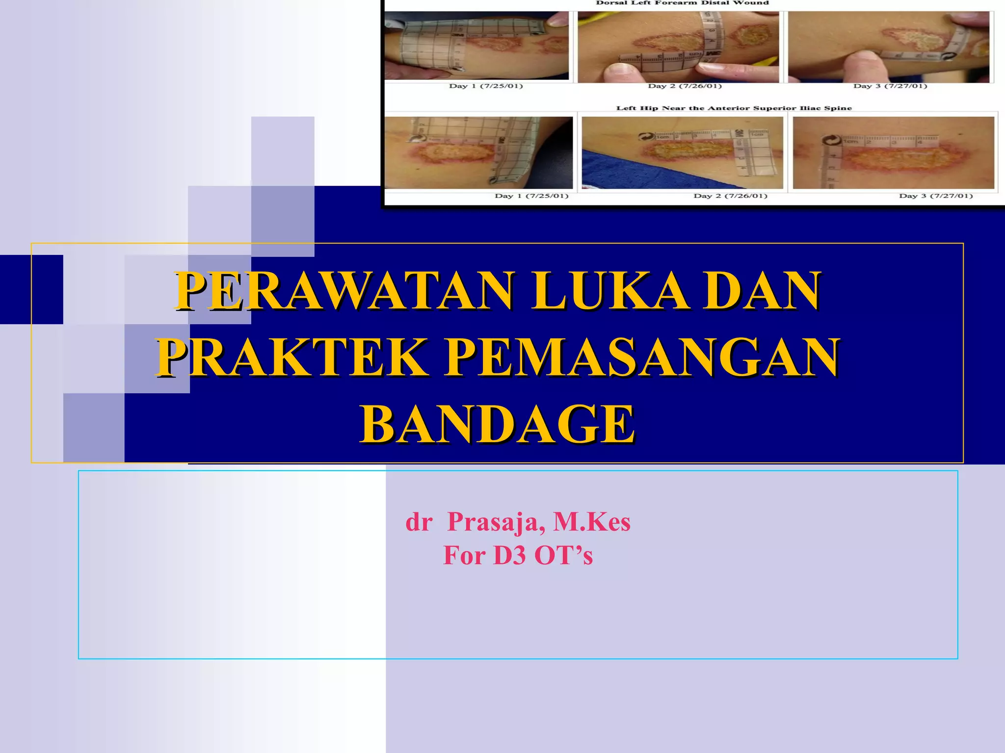 Ppt perawatan luka ot | PPT