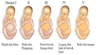 Eva Zuli Oktavia,S.Tr.Keb., M.Tr.Keb_Pertemuan Komplikasi Persalinan_ppt pertemuan 5.pptx