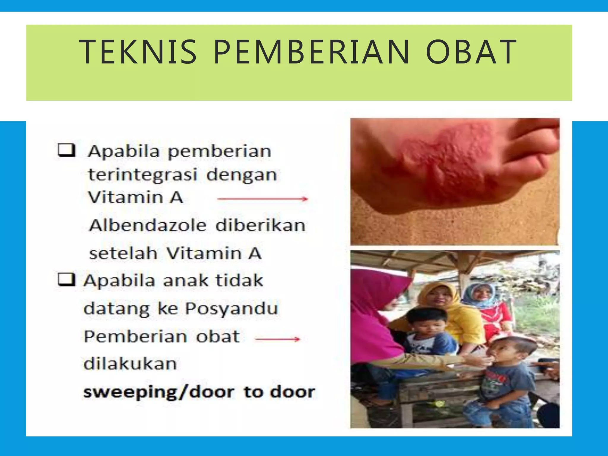 PPT Pertemuan Sosialisasi POPM Cacingan Tahun 2022, edit.ppt