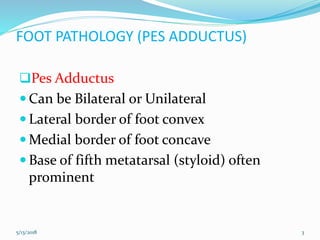 Ppt (pes adductus) | PPTX | Physical Therapy | Wellness
