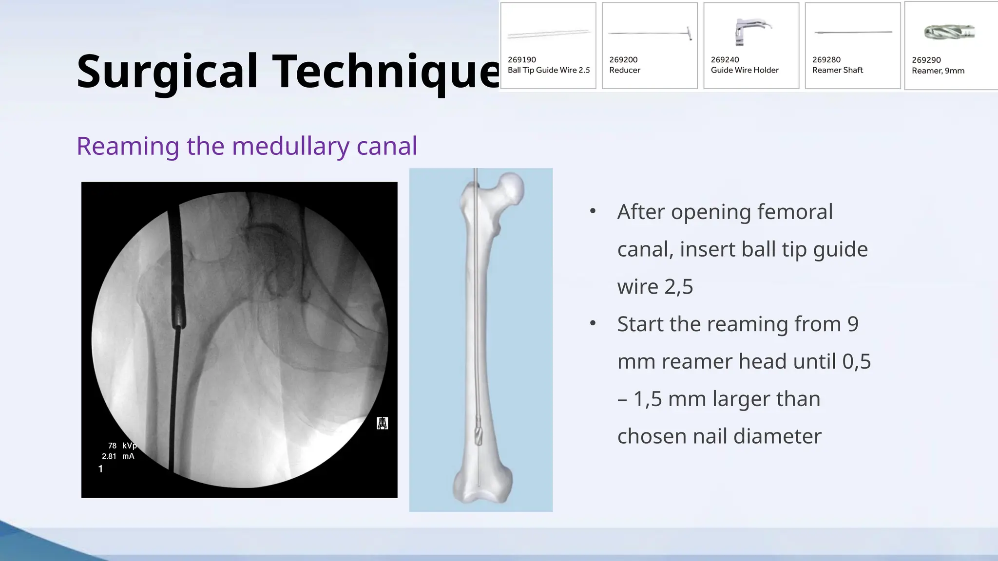 PPT Proximal Femoral Nail, Principles and Techniques | PPTX