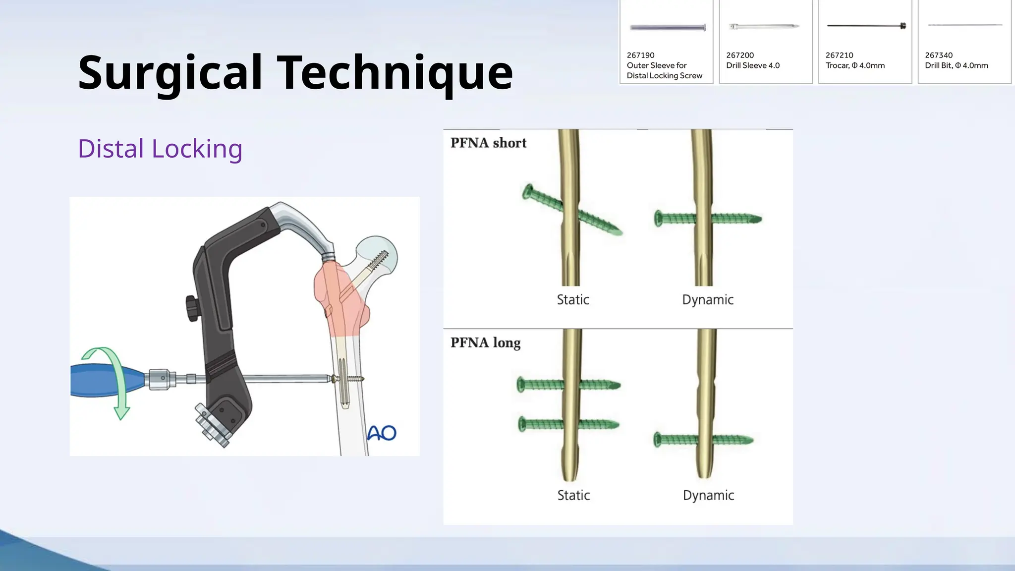 PPT Proximal Femoral Nail, Principles and Techniques | PPTX