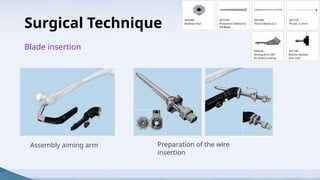 PPT Proximal Femoral Nail, Principles and Techniques | PPTX