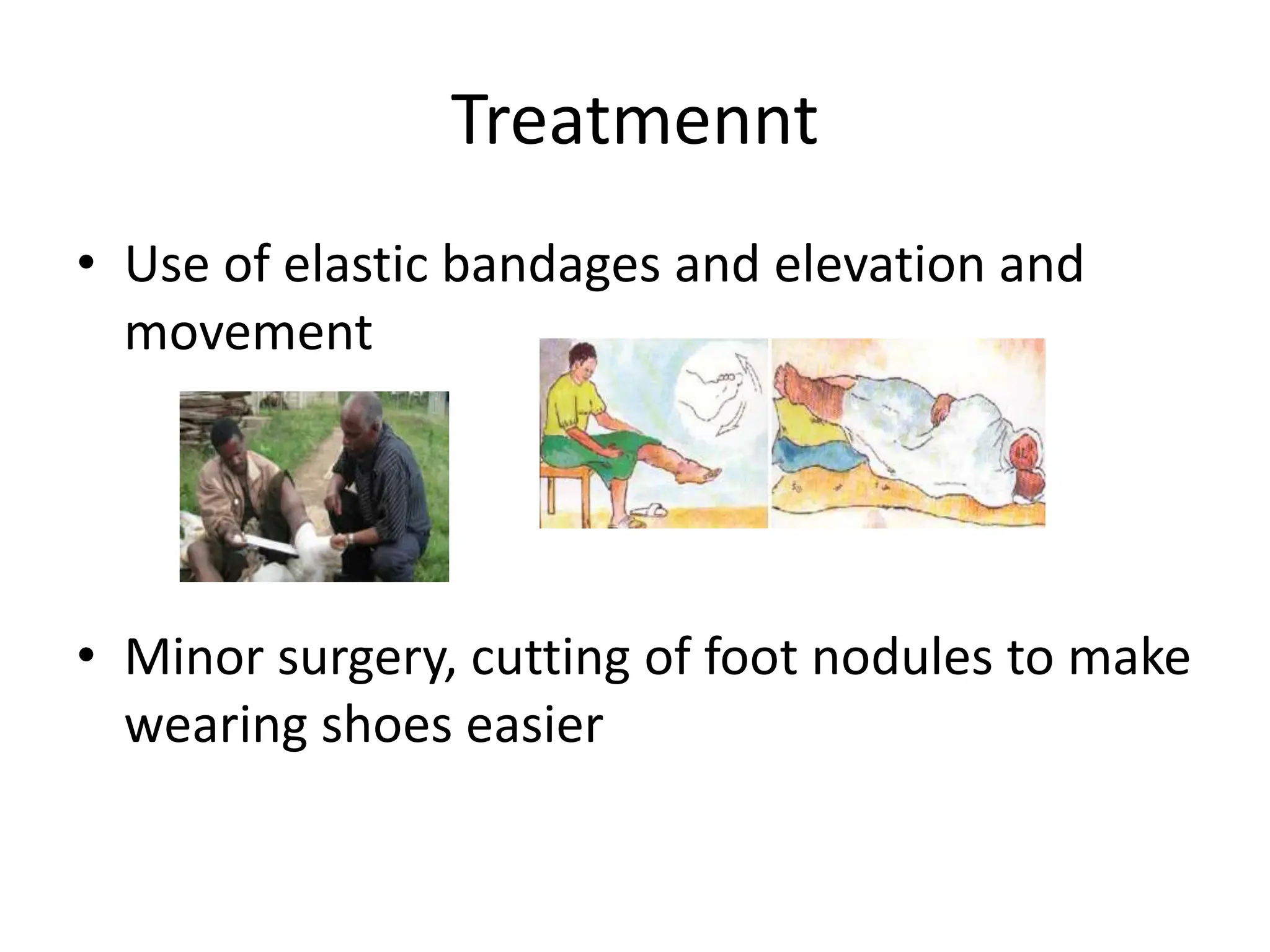 Podoconiosis, types and characteristics..pptx