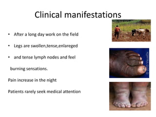 Podoconiosis, types and characteristics..pptx