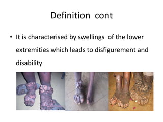 Podoconiosis, types and characteristics..pptx