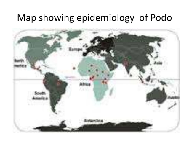 Podoconiosis, types and characteristics..pptx