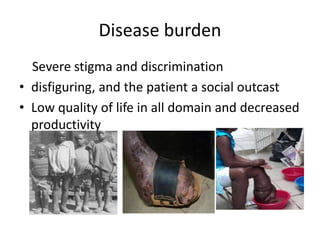 Podoconiosis, types and characteristics..pptx