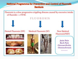 Fluorosis- A Public Health Hazards under NCD | PPT