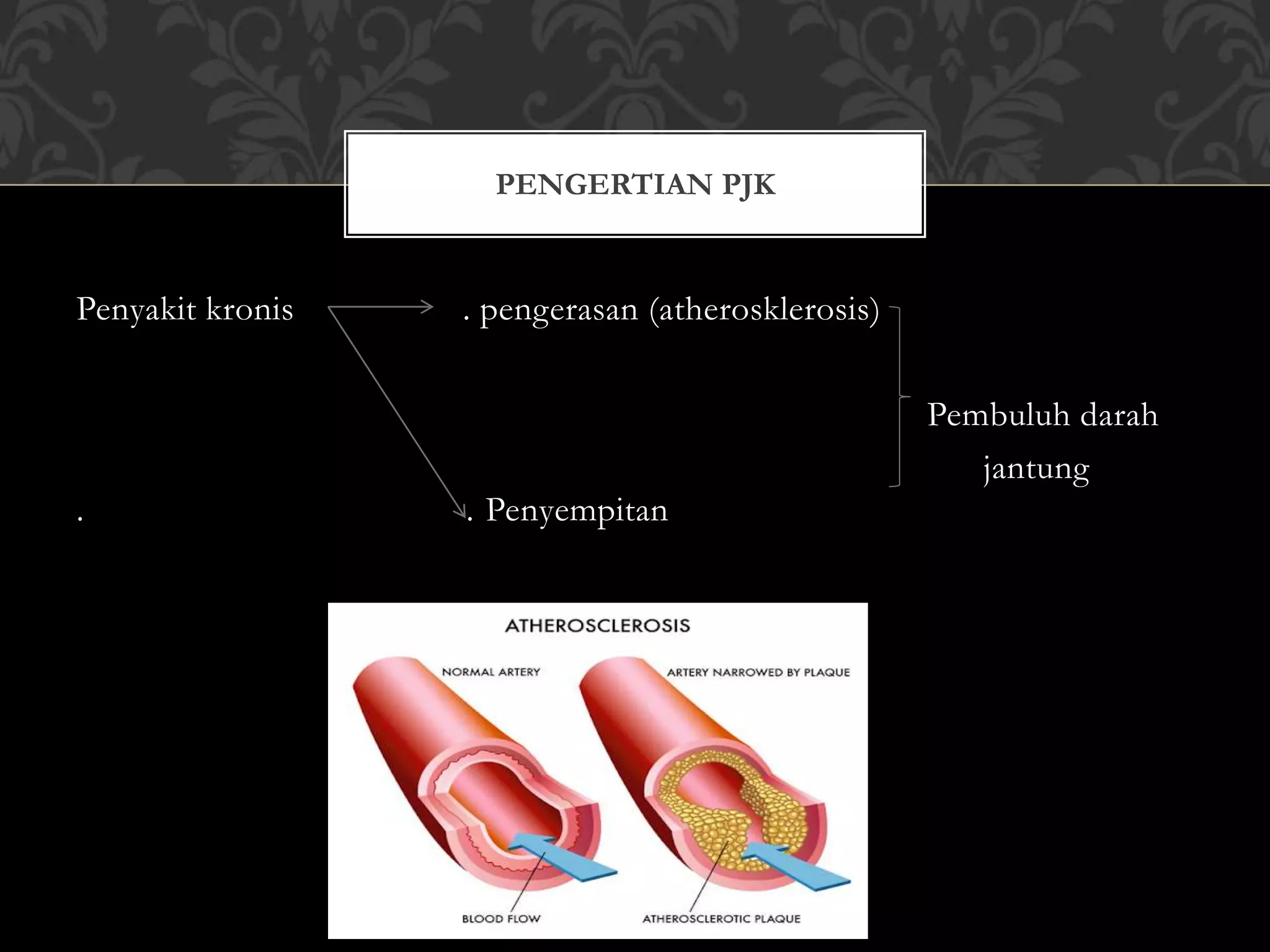 Ppt pjk | PPTX