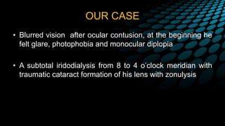 Iridodialysis repair with modified double armed closed chamber ...