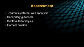 Iridodialysis repair with modified double armed closed chamber ...