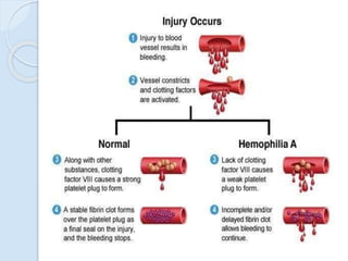 Bleeding disorder mbbs 2nd year, bams 2nd proff | PPT