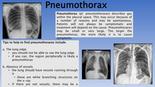 PPT Pneumothoraks.pptx
