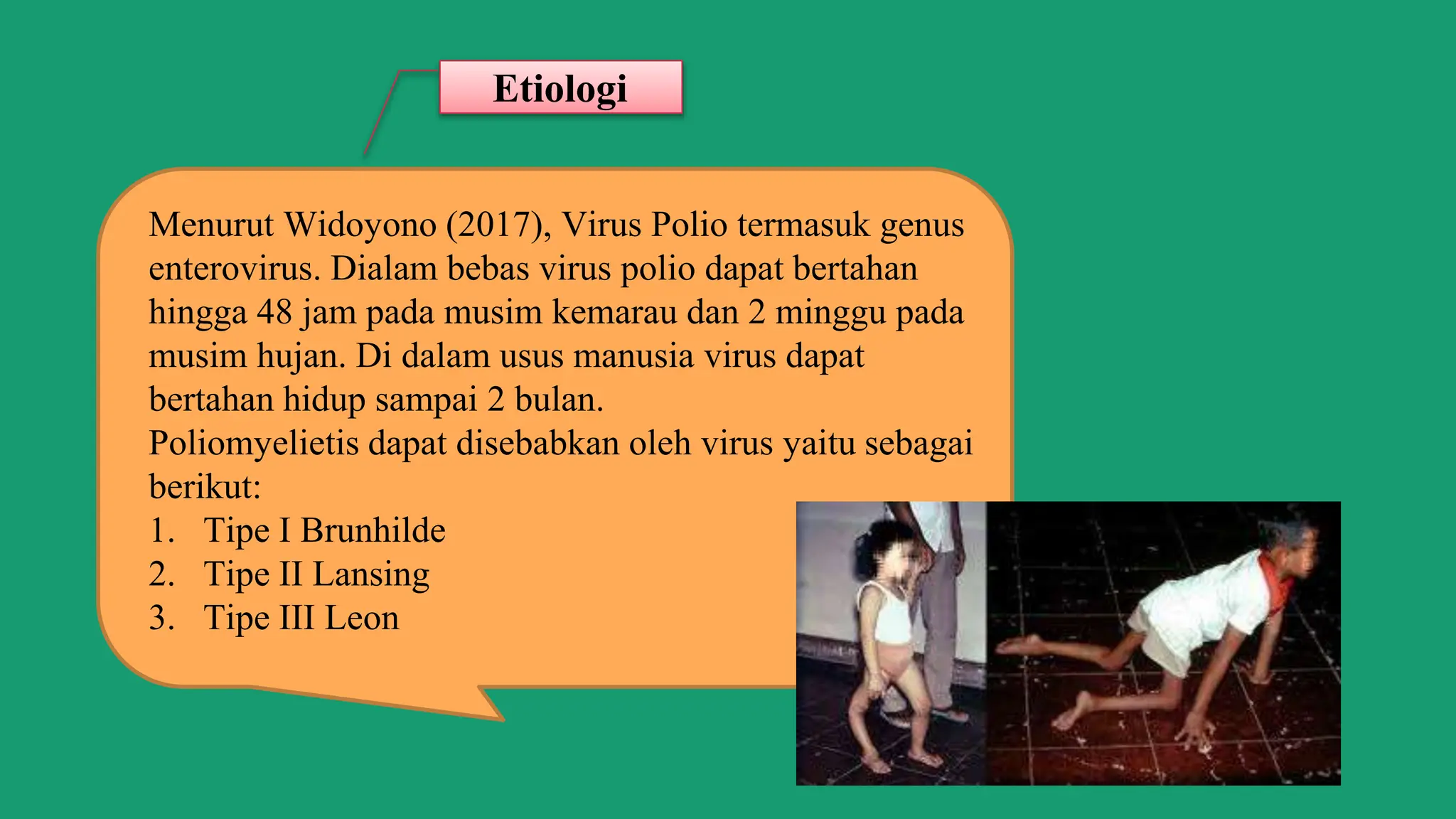 PPT POLIO KMB kelompok tujuhfffssffsdfdf | PPTX
