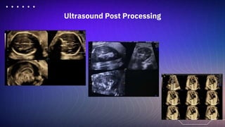 PPT Post Processing.pptx