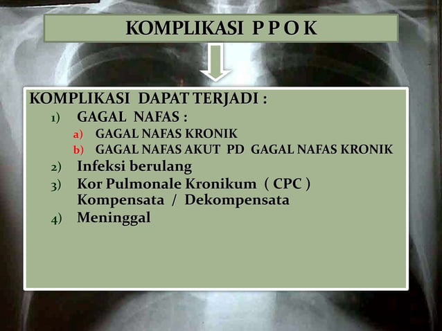 Ppt ppok | PPTX