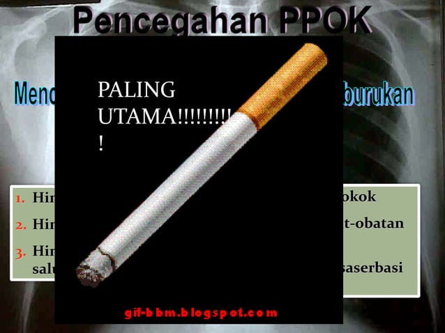 Ppt ppok | PPTX