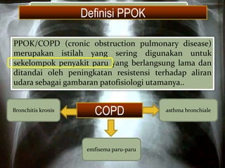 Ppt ppok | PPTX