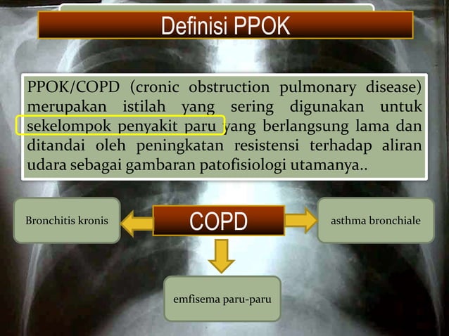 Ppt ppok | PPTX