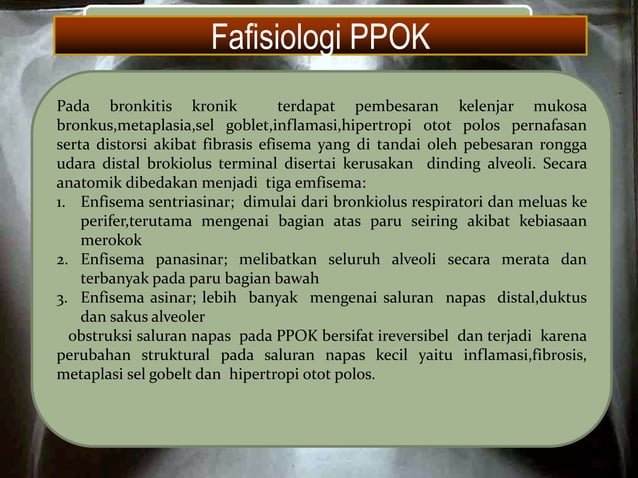 Ppt ppok | PPTX