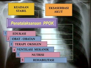 Ppt ppok | PPTX