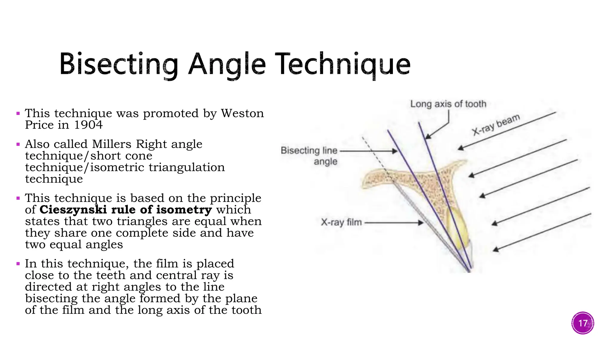 Radiographic Techniques in Pediatric Dentistry- part one , Essentials ...