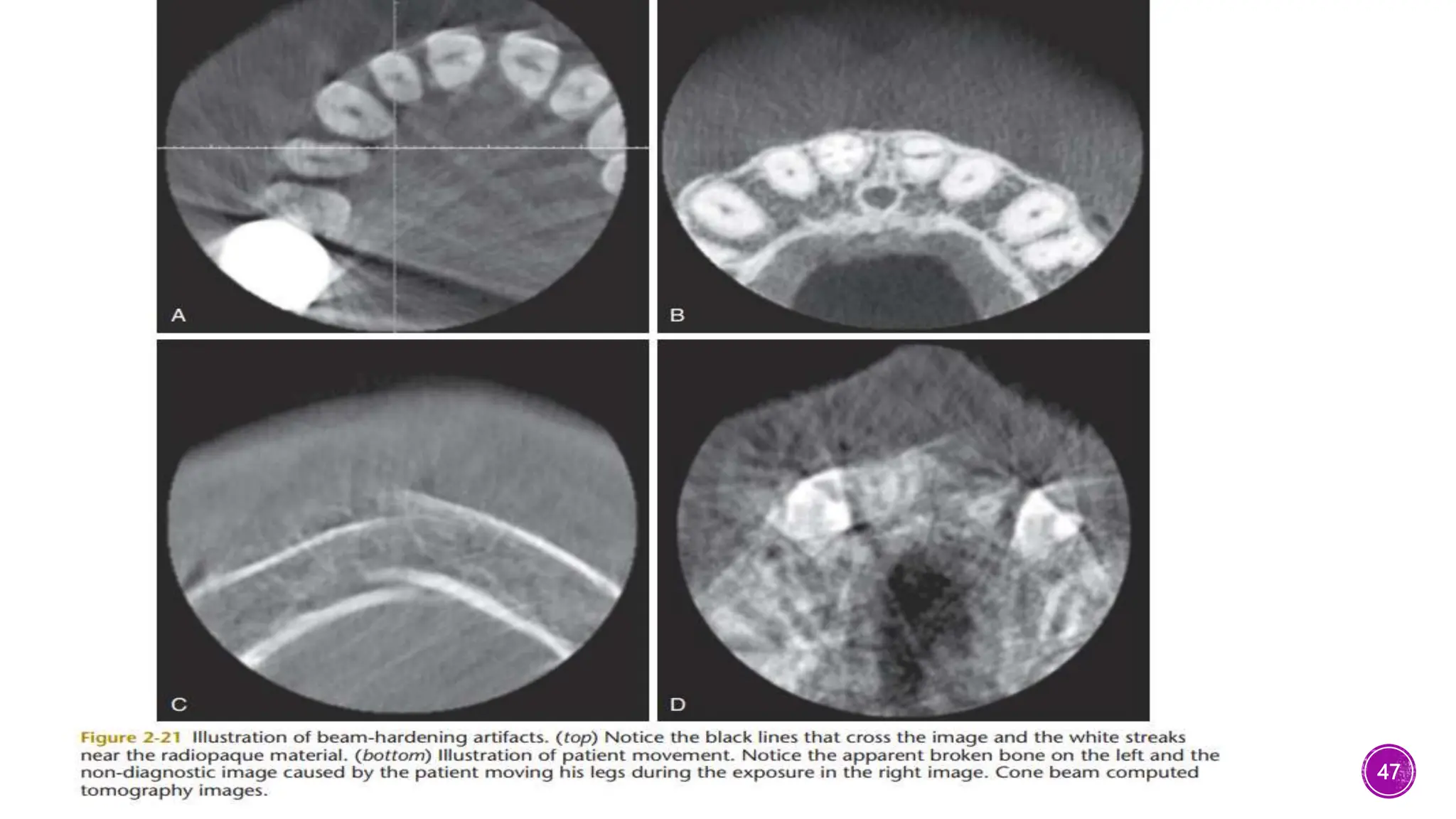 Radiographic Techniques in Pediatric Dentistry- part one , Essentials ...