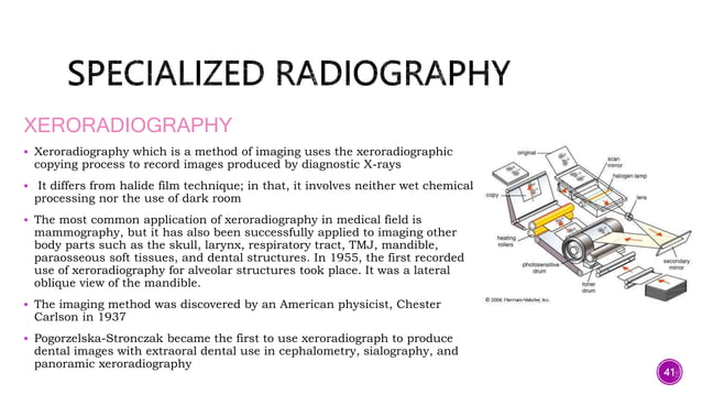 Radiographic Techniques in Pediatric Dentistry- part one , Essentials ...