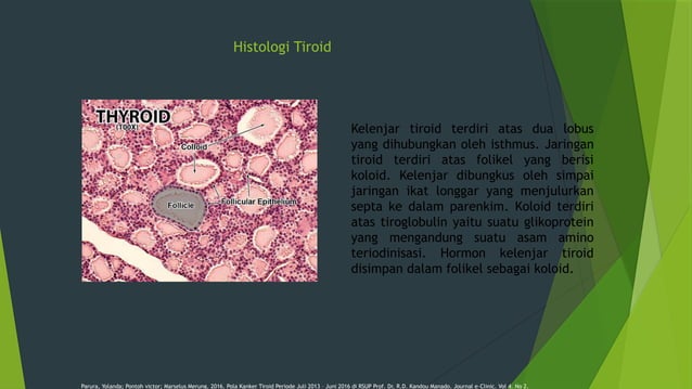 PPT Proposal - dr. Abdul Samad S. Supu - C045232006 - Kanker Tiroid.pptx