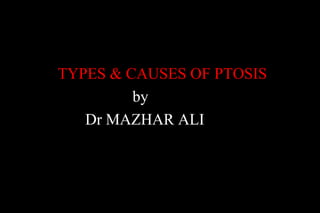 ptosis ppt | PPT