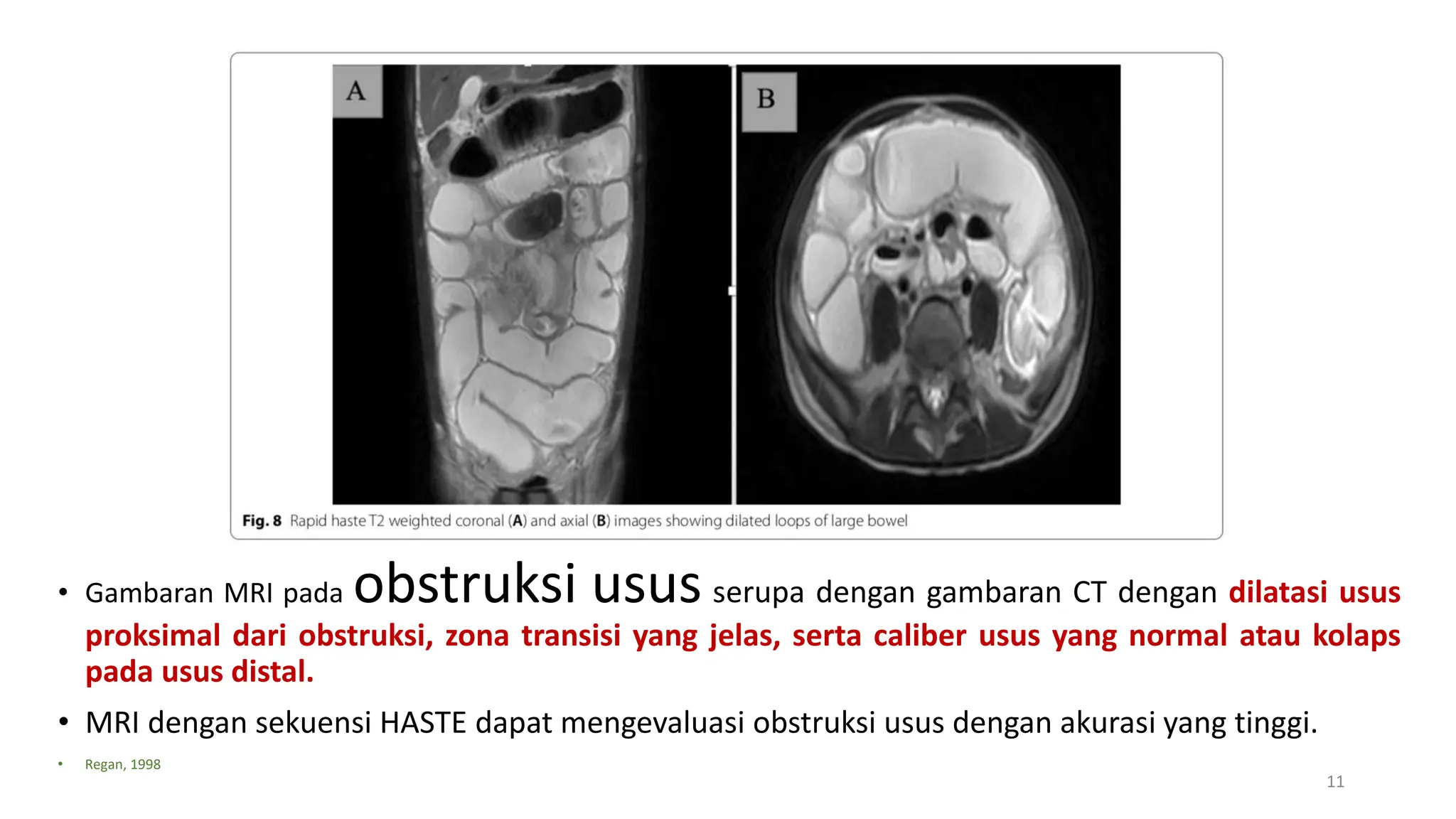 PPT Radiologi the role of magnetic resonance.pptx