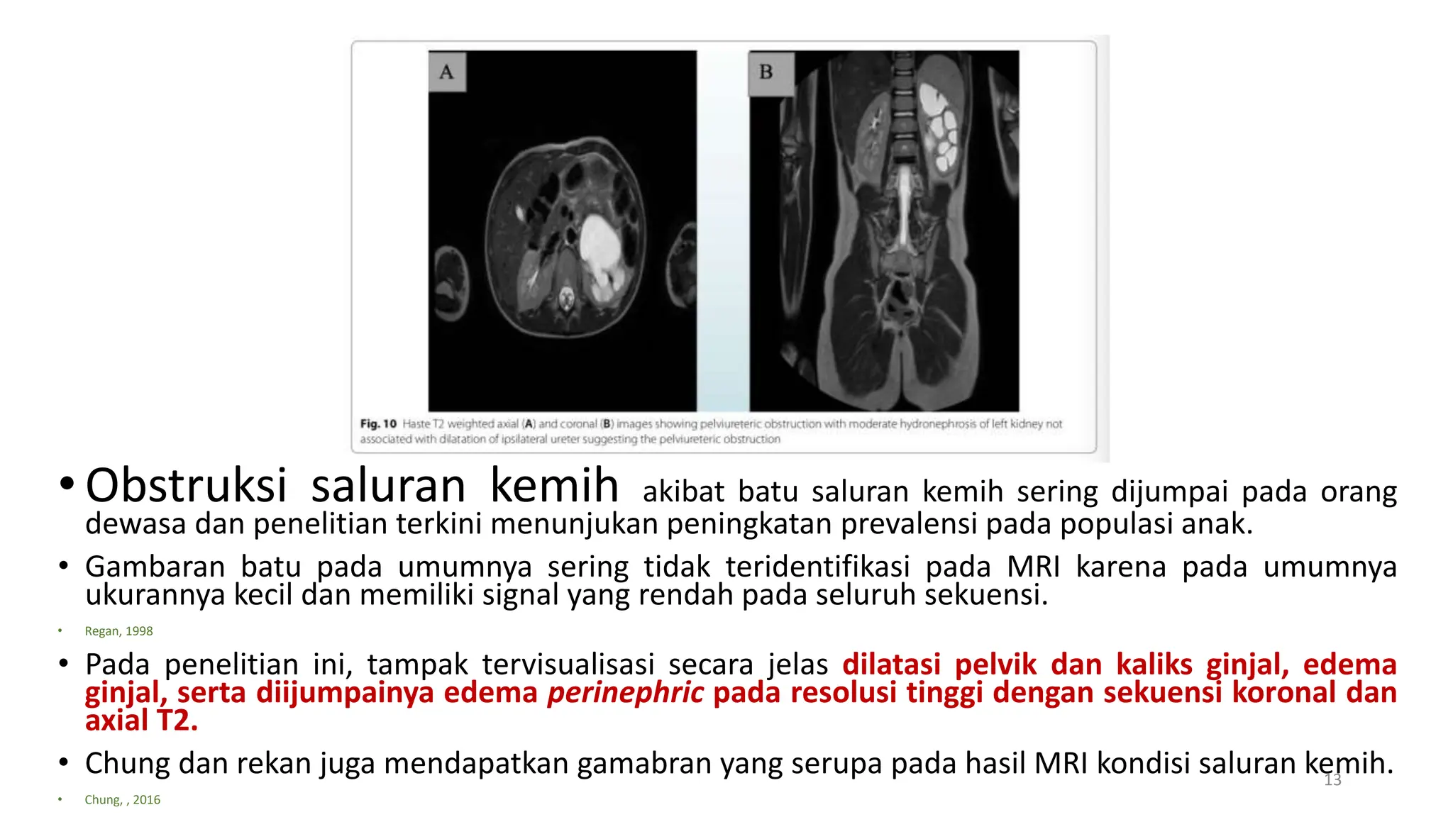 PPT Radiologi the role of magnetic resonance.pptx