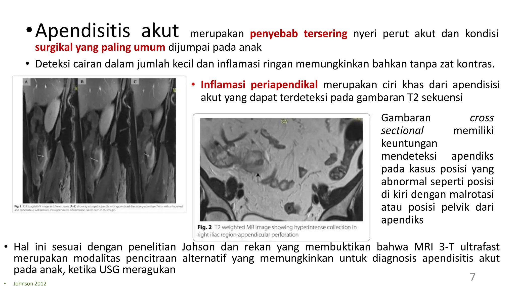 PPT Radiologi the role of magnetic resonance.pptx