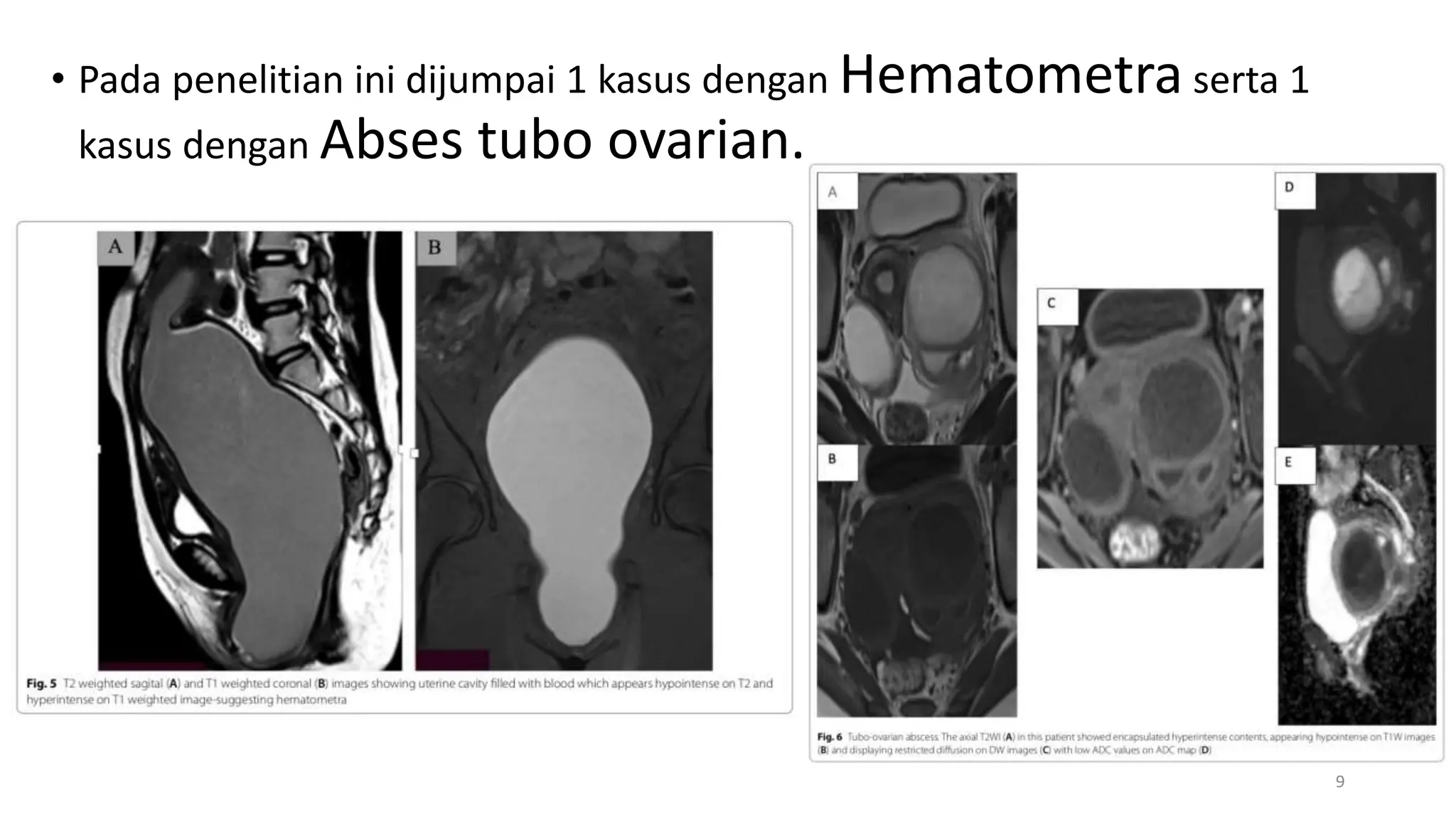 PPT Radiologi the role of magnetic resonance.pptx