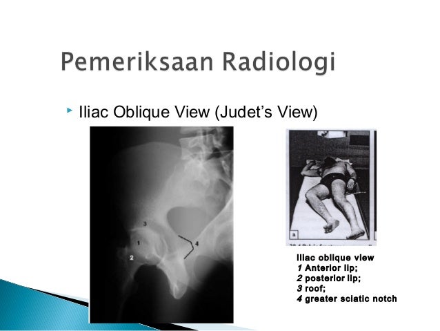 trauma pelvis penatalaksanaan