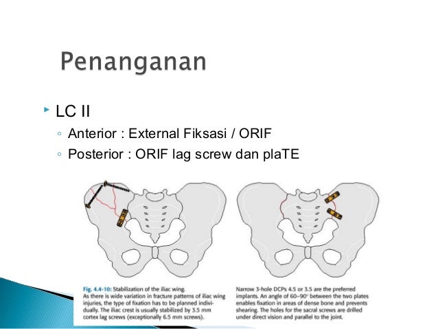 trauma pelvis penatalaksanaan