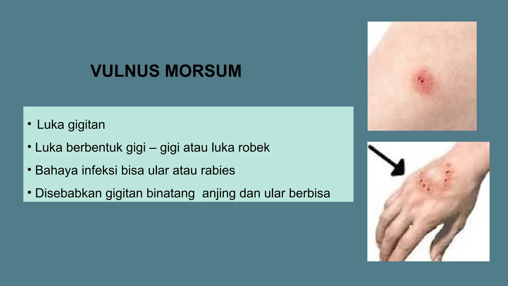 PPT RAWAT LUKA DAN TEHNIK PENANGANAN LUKA | PPTX