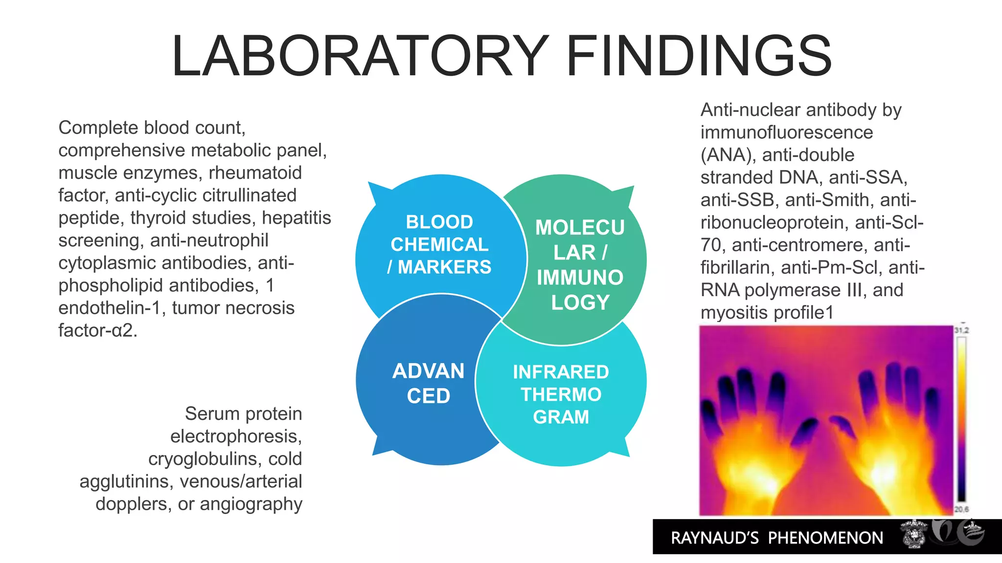 PPT Raynaud Phenomenon ENG 090321.pptx