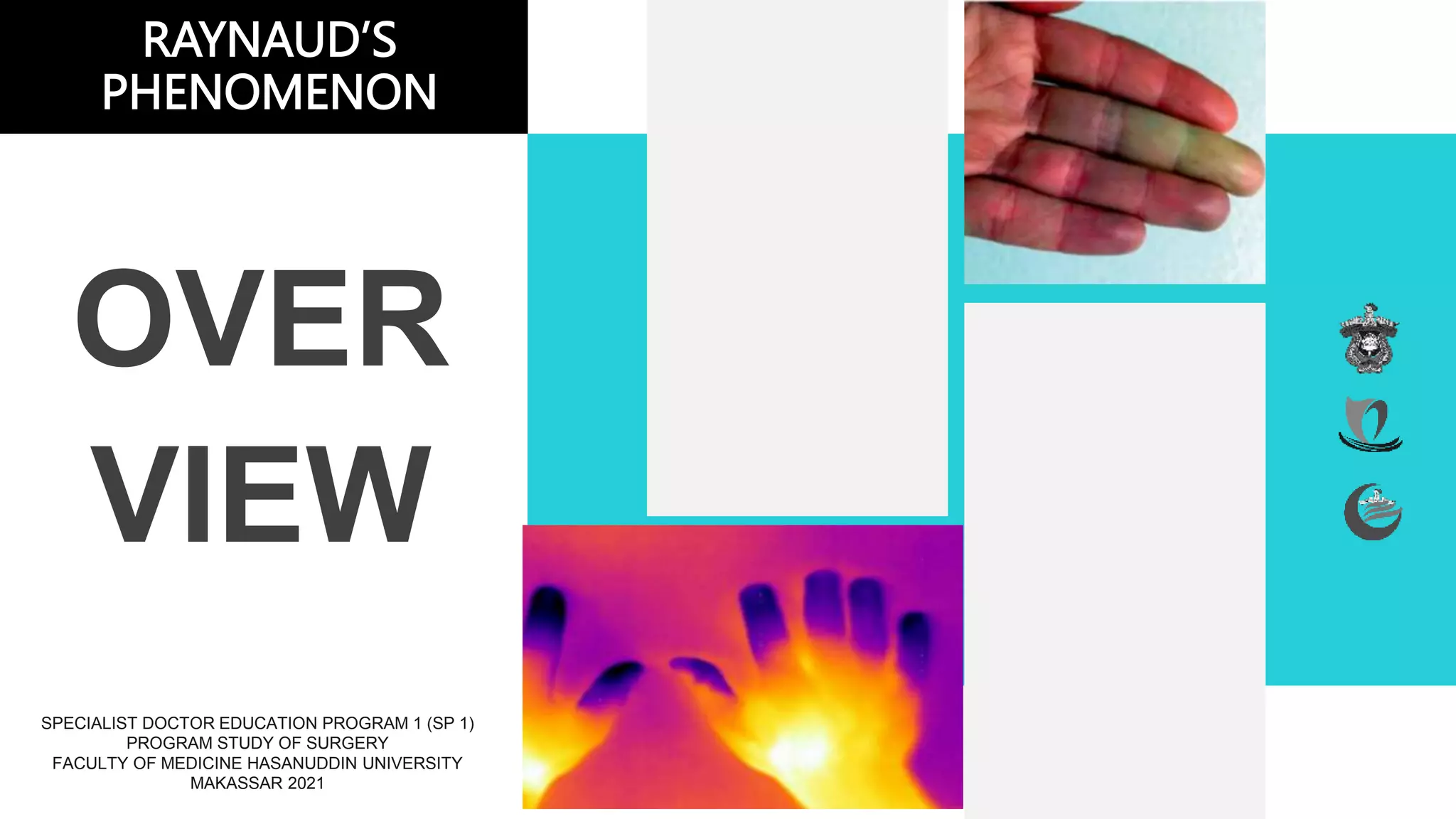 PPT Raynaud Phenomenon ENG 090321.pptx