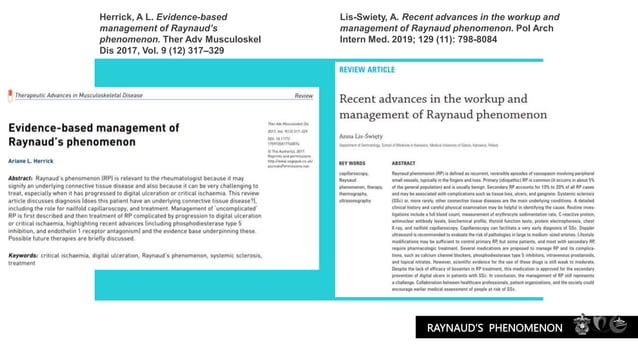 PPT Raynaud Phenomenon ENG 090321.pptx