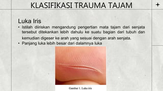ppt refarat.pptx