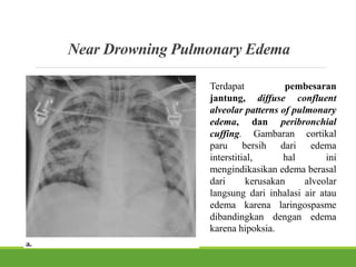 PPT_REFERAT_EDEMA_PARU.ppt