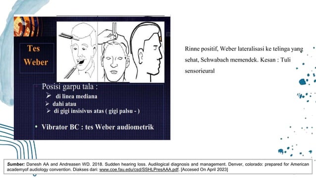 PPT referat tuli mendadak akbar.pptx