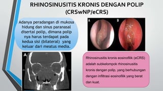 ppt refrat 2 rsk1 epos.pptx