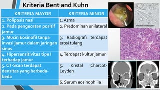 ppt refrat 2 rsk1 epos.pptx