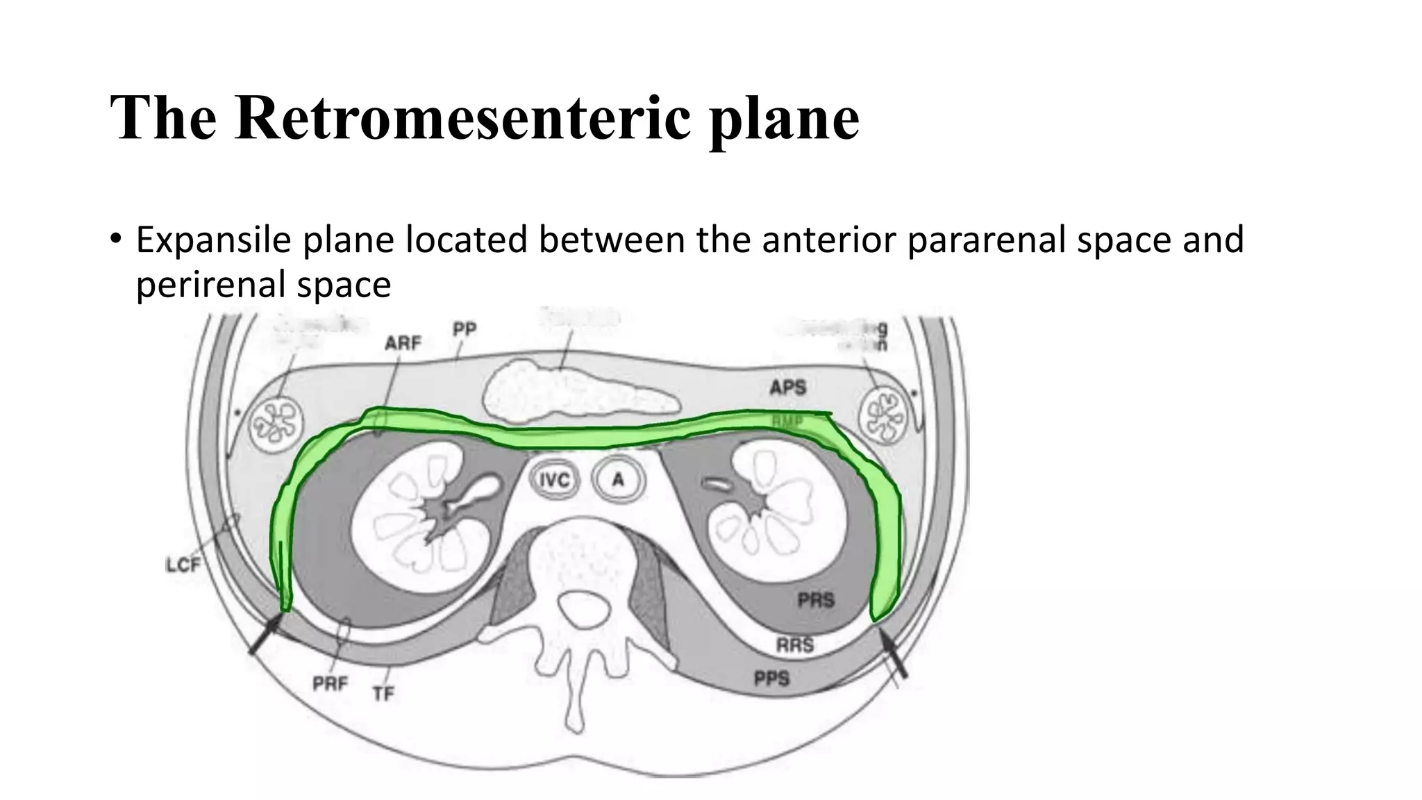 radiological anatomy of retroperitoneum powerpoint | PPTX