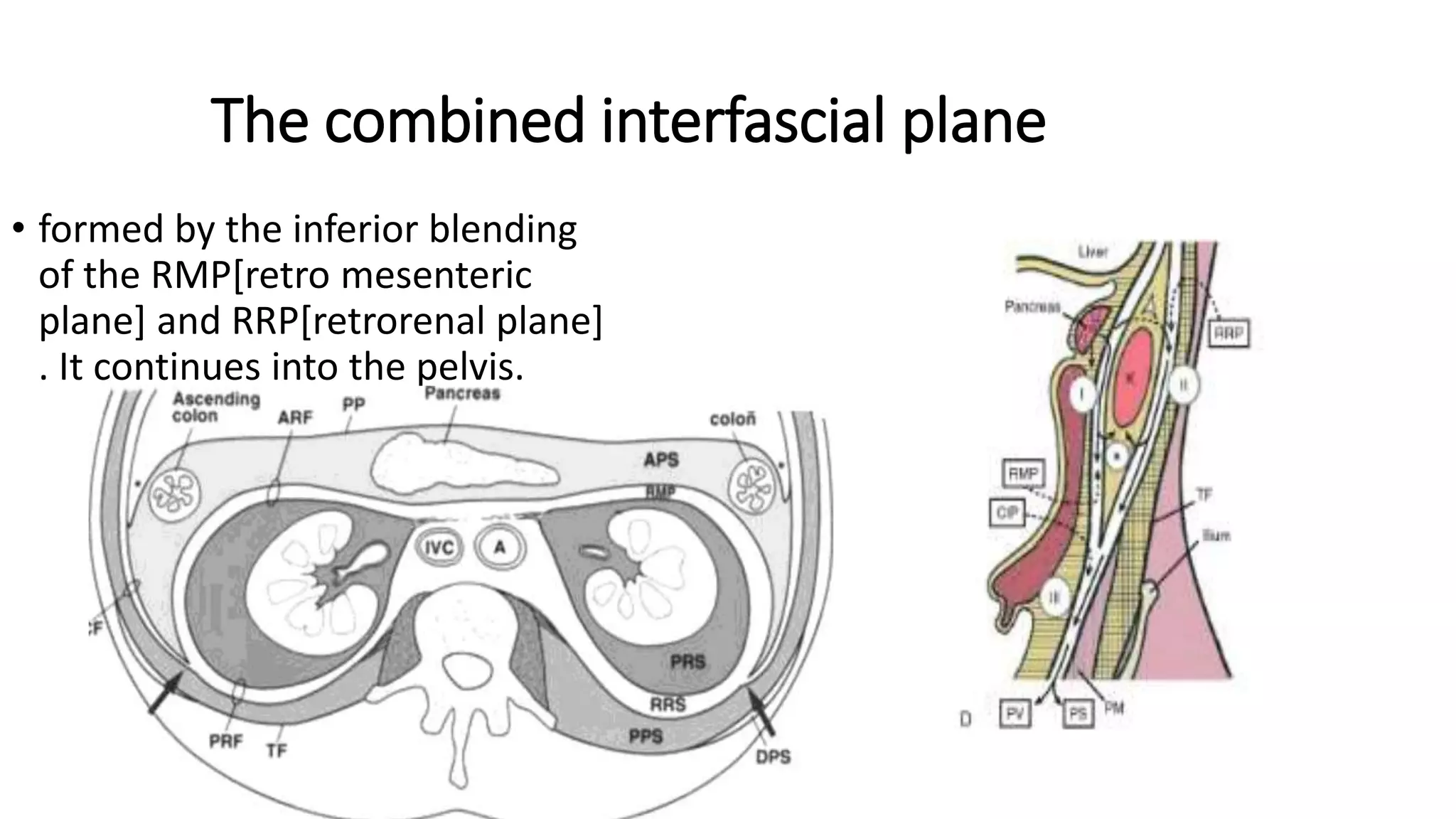radiological anatomy of retroperitoneum powerpoint | PPTX